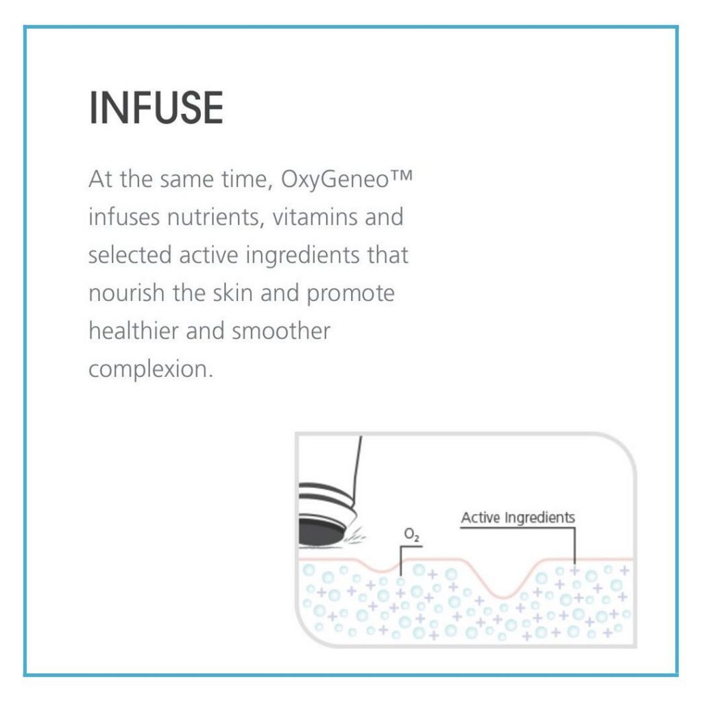 OxyGeneo 3-in-1 Super Facial Toronto - VS MedSpa Skin Clinic