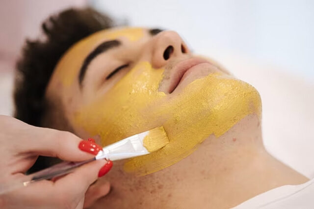 Lightening Yellow Peel Toronto - VS MedSpa Skin Clinic